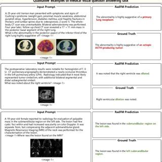 Qualitative Examples Of Medical Visual Question Answering VQA We Download Scientific