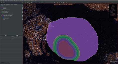 resolving image hierarchy for margin annotation in qupath usage