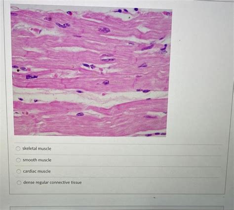 Solved Skeletal Muscle Smooth Muscle Cardiac Muscle Dense