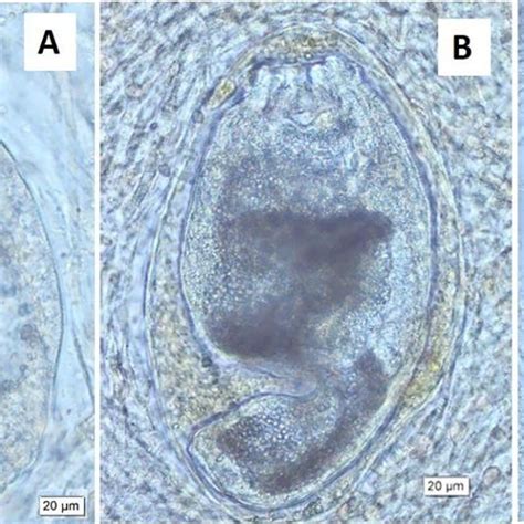 Metacercariae Belonging To Bucephalidae A Excysted Metacercaria Of Download Scientific