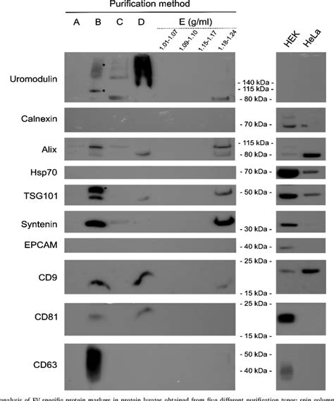 Figure 2 From Comparing Small Urinary Extracellular Vesicle Purification Methods With A View To