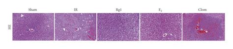 Ginsenoside Rg1 Activates Erα Upregulates Yap Expression And
