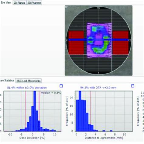 Dose Distribution Dose Deviation Distance To Agreement And Gamma Download Scientific Diagram