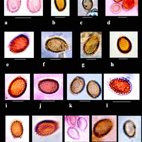 Spores Of Ganoderma Species Bar 5 μm A Ganoderma Applanatum B Download Scientific