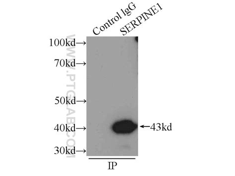 Vitronectin Antibody 15833 1 Ap Proteintech