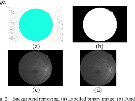 figure 1 from classification of fundus images based on multifractal