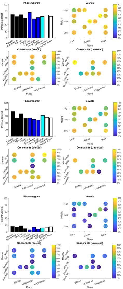 Visualization Of Speech Perception Errors Through Phoneme Alignment Computational Audiology