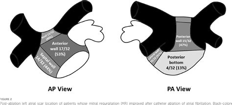 Figure 2 From Clinical Significance Of Substrate Characteristics And