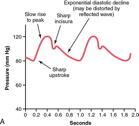 Monitoring Clinical Tree