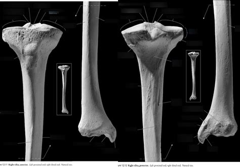 Tibia Diagram Quizlet
