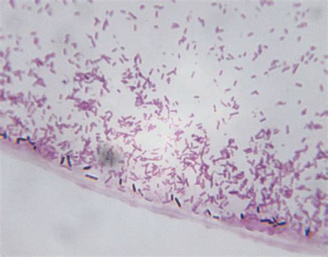 Eukaryotic And Prokaryotic Cells Microscope