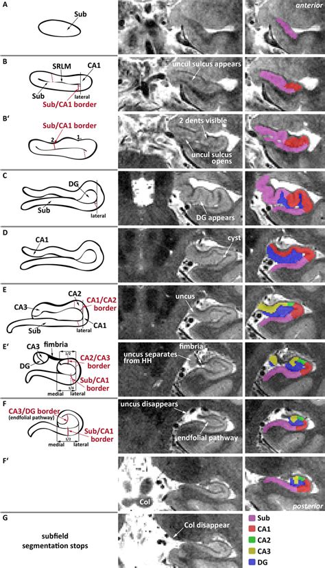 Rules For Hippocampal Subfield Segmentation Shown On The Relevant