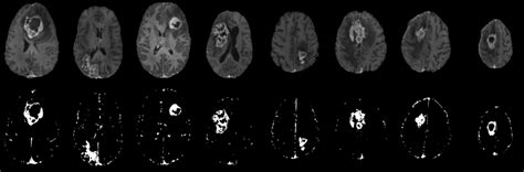 Illustration Of Eight Representative Ce T1 Images And Corresponding