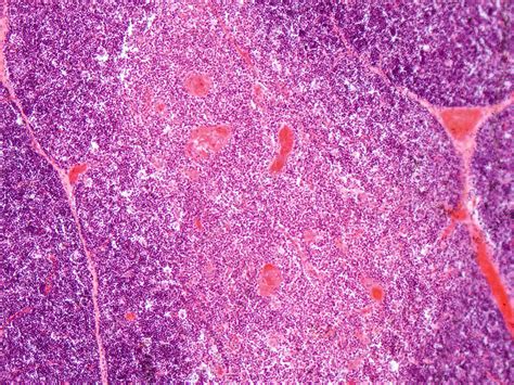 Thymus Gland Human Infant Lm Stock Image C0362423 Science