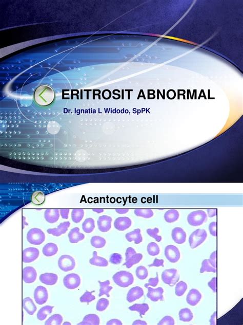 Eritrosit Abnormal Dr Ignatia L Widodo Sppk Pdf