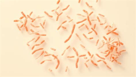 What Are Coliform Bacteria Home Water Treatment Systems