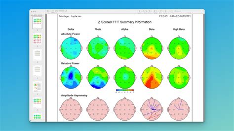 How To Use Loreta Eeg Source Localization To Understand Qeeg Peak