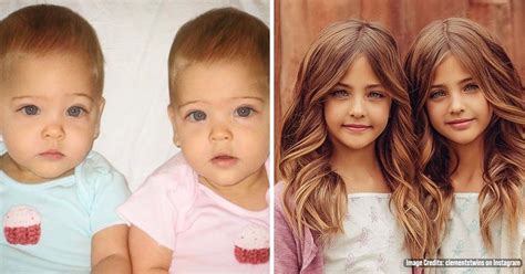 Years Ago They Were Called ‘the Worlds Most Beautiful Twins Now