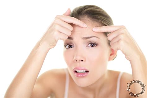 How To Treat Pimple Scars Dr Donna Chow