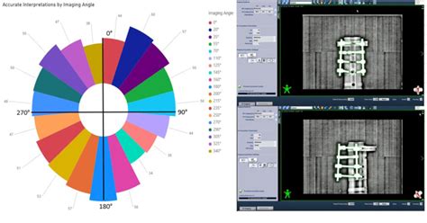Figure 4 From Exploring The Use Of Contour Based Intrafraction Motion Review For Spine
