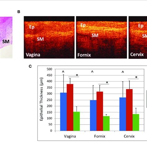 Baseline Optical Coherence Tomography OCT And Histology Findings Download Scientific