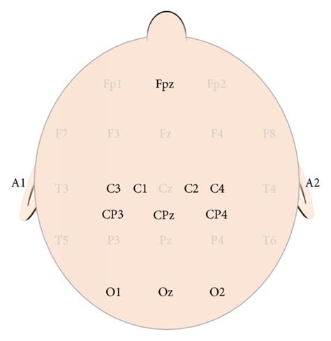 Electrode Positions Used For Stimulating Tcemep And Recording Ssep