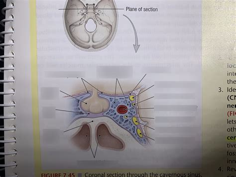 Coronal Section Through Cavernous Sinus Diagram Quizlet