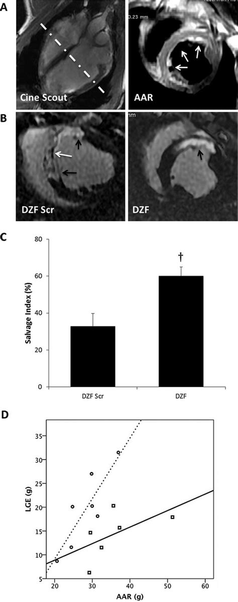 Cmr Assessment Of Myocardial Salvage And Heart Function Following I R