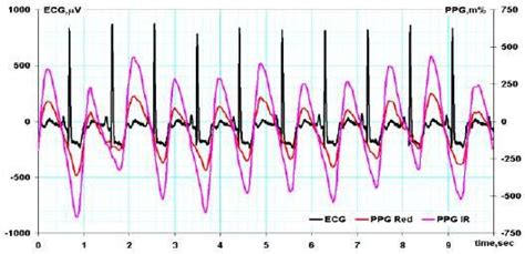 Ecg Ppg Excel Graph Download Scientific Diagram