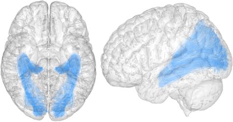 Reference Optic Radiation Bundles Resulting From The Inter Subject