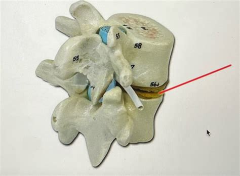 Solved Can You Help Me Identify The Highlighted Structure 58 55 564