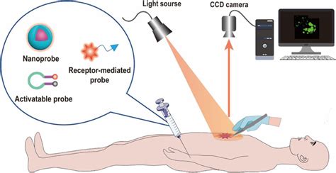 Schematic Illustration Of Fluorescence Imaging‐guided Tumor Resection