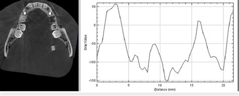 Profile Line On Imagej Software To Measure The Artifact Download
