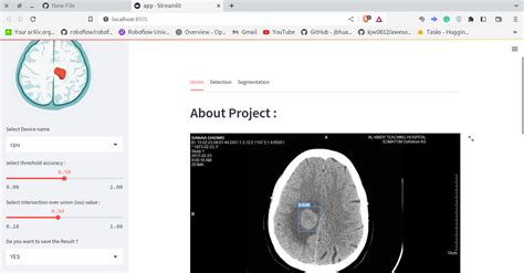 Github Kirouane Ayoub Brain Tumors Detection And Segmentation