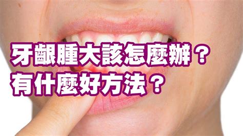 牙齦腫大該怎麼辦？有什麼好方法？ Youtube