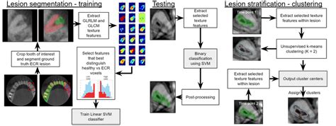 Schematic Overview Of The Proposed ECR Lesion Segmentation And