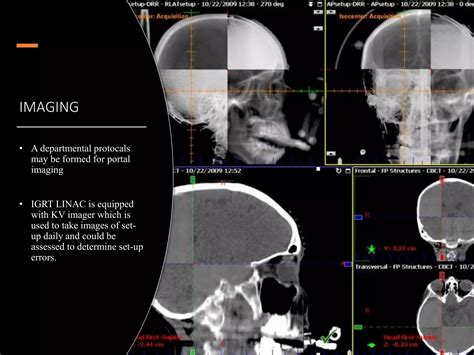 Common Set Up Errors And How To Minimize Them Ppt