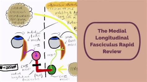 Medial Longitudinal Fasciculus Anatomy