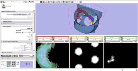 2009 Winter Project Week Stochastictractography Namic Wiki
