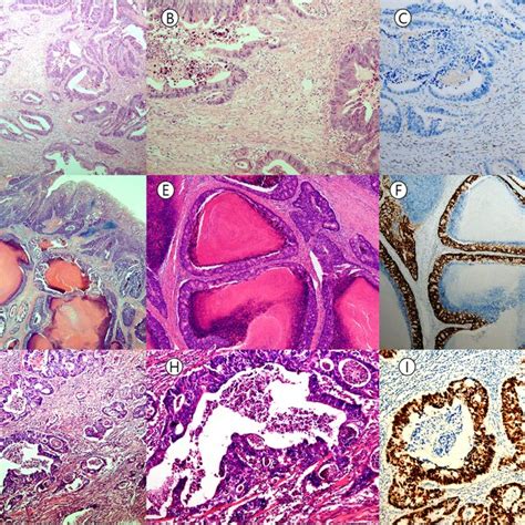 Schematic Structure Of Tp53 And Its Different Domains Mutations Download Scientific Diagram