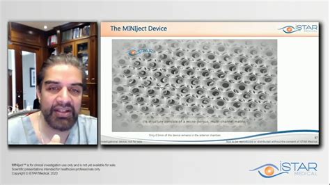 Istar Segments 20200604 Istar The Miniject™ Next Generation Supraciliary Device On Vimeo