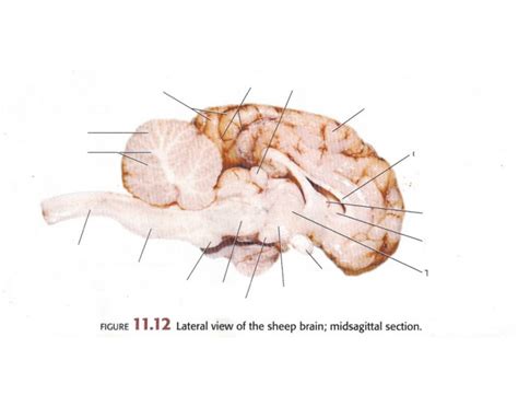 Medial View Of Sheep Brain