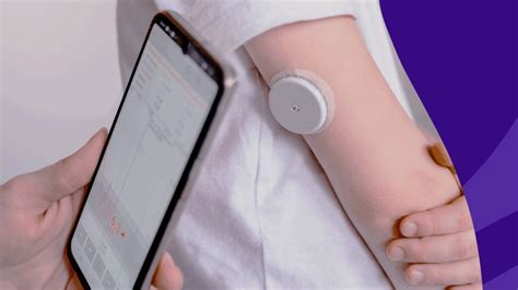 Dexcom Vs Freestyle Libre Differences Similarities And Which Is Better For You