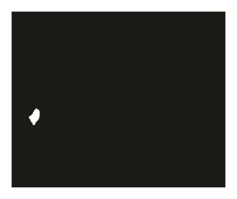 Laser Spot Segmenting Via Improved Morphological Band Pass Filter A Download Scientific