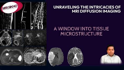 Unravelling The Intricacies Of Mri Diffusion A Window Into Tissue Microstructure Anoop Singh
