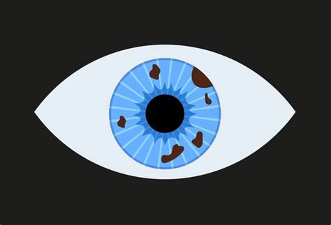 36 En La Categoría «bleb In Eye De Imágenes Fotos De Stock E