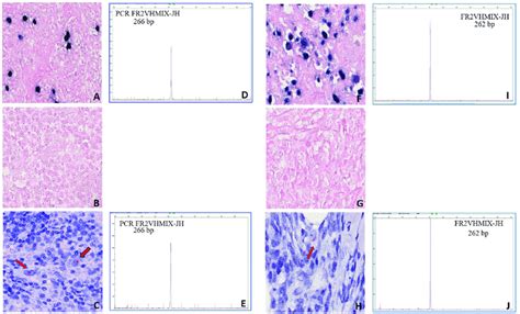 Rnascope And Clonality Analyses Of An Ebv Positive Chl Case Relapsed As Download Scientific