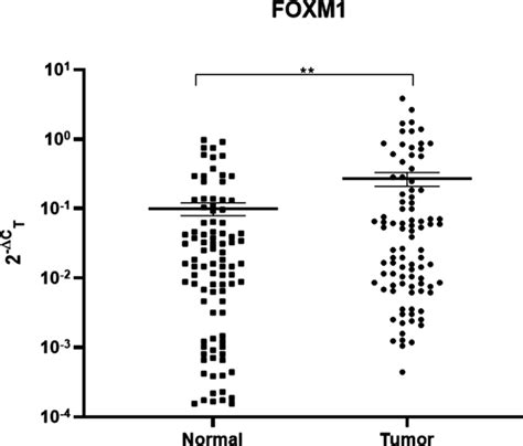 Expression Profile Of Foxm1 Gene Tumor Vs Control In Colorectal