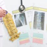 Women At Risk Of Low Bone Density And Fractures Beammed