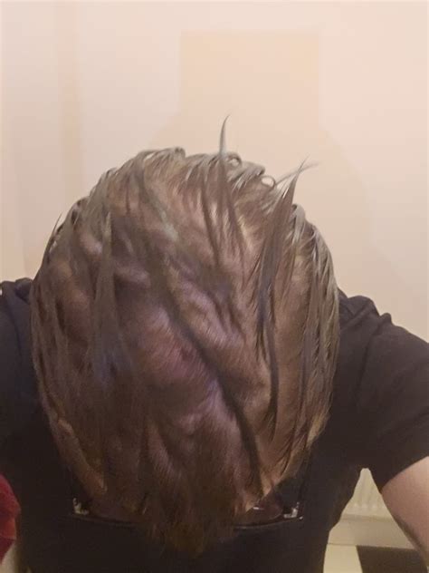 Diffuse Thinning Mpb Paranoia Rhairloss